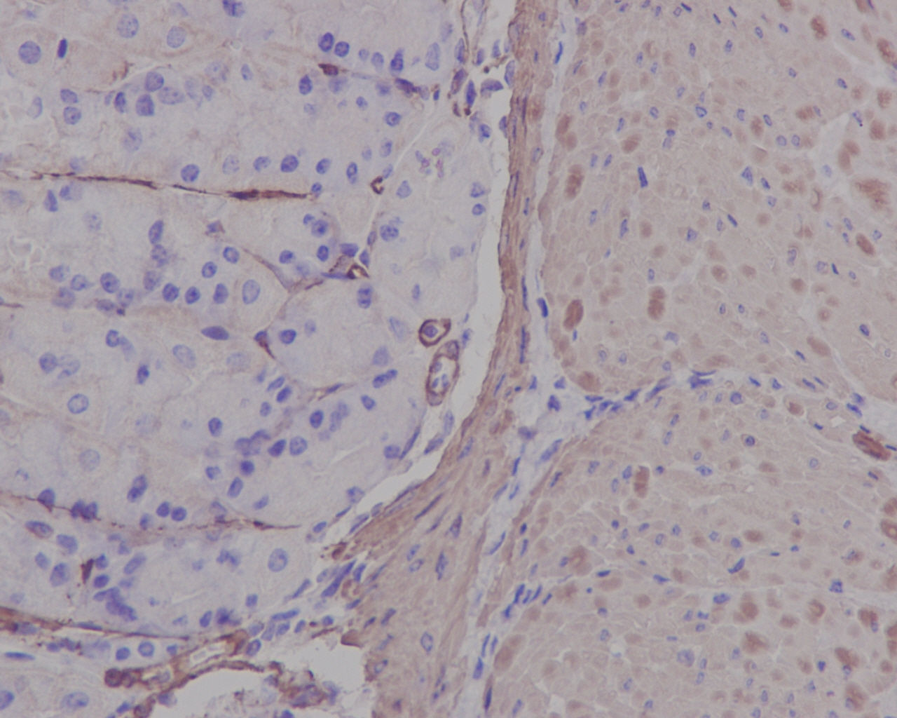 Anti-Alpha smooth muscle Actin antibody [ab124964], EPR5368 | Danaher ...