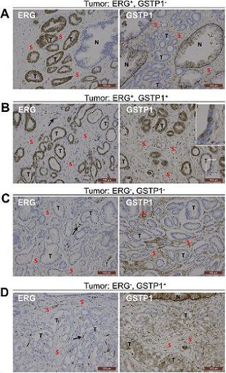 Anti-ERG [EPR3864] ab92513 Recombinant | Danaher Life Sciences