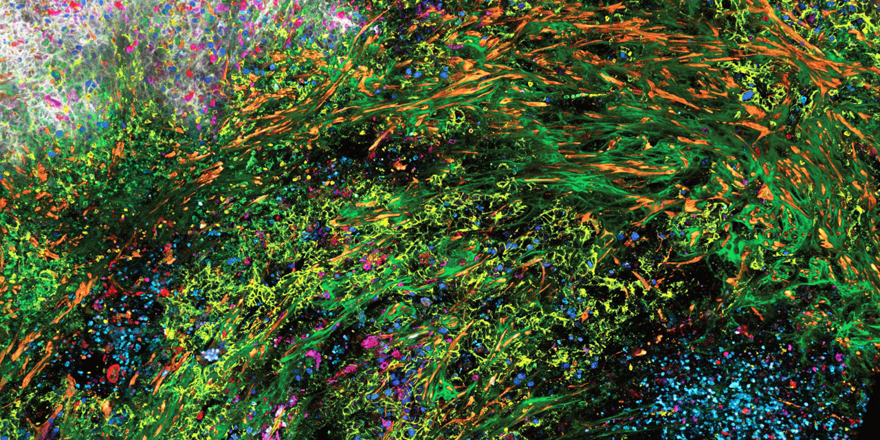SpectraPlex for Spatial Biology - Applications | Products | Leica ...
