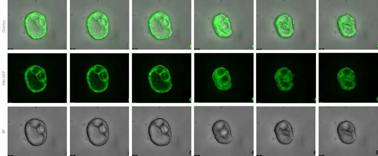 How To Perform Fast & Stable Multicolor Live-Cell Imaging | Danaher ...