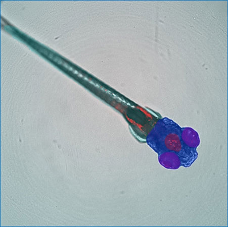 IN Carta Image Analysis Software | Danaher Life Sciences