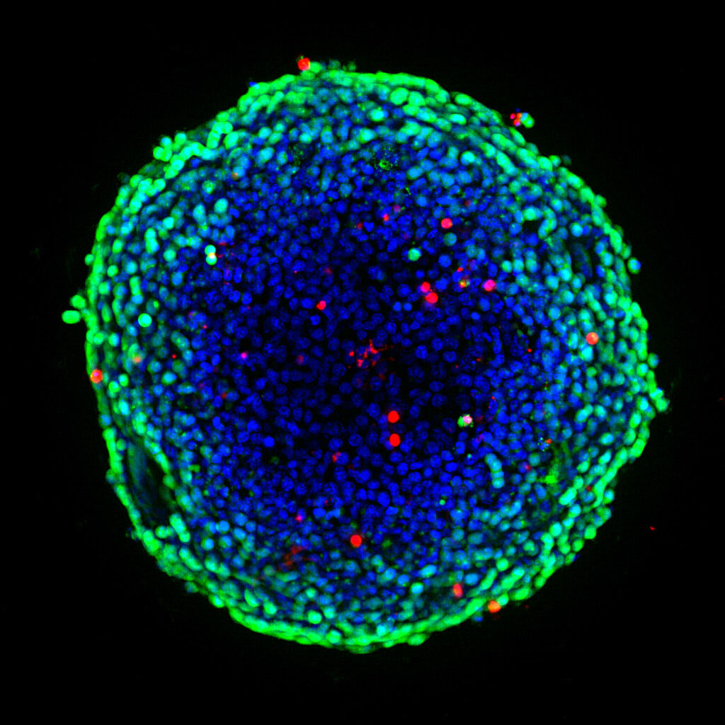 ImageXpress® Micro Confocal High-Content Imaging System | Danaher Life ...